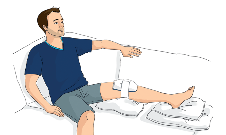 Entorse - Causes, symptômes et traitements de l'entorse - Orliman