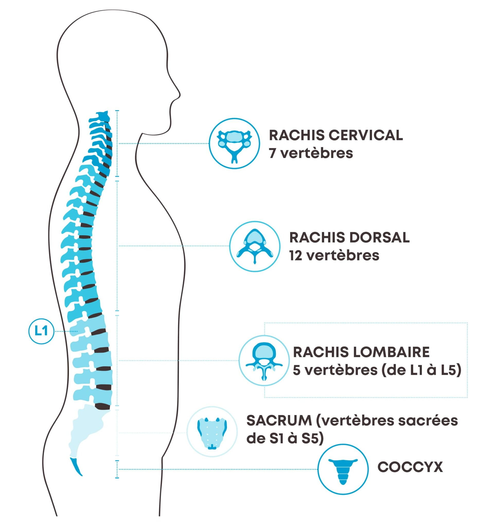 Sciatique - Causes, symptômes et traitements de la sciatique - Orliman